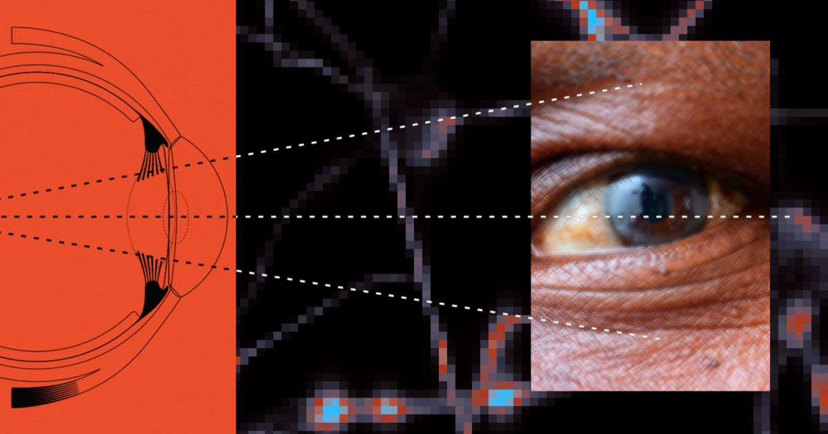 Brain implant for “artificial vision” is still working after 2 years