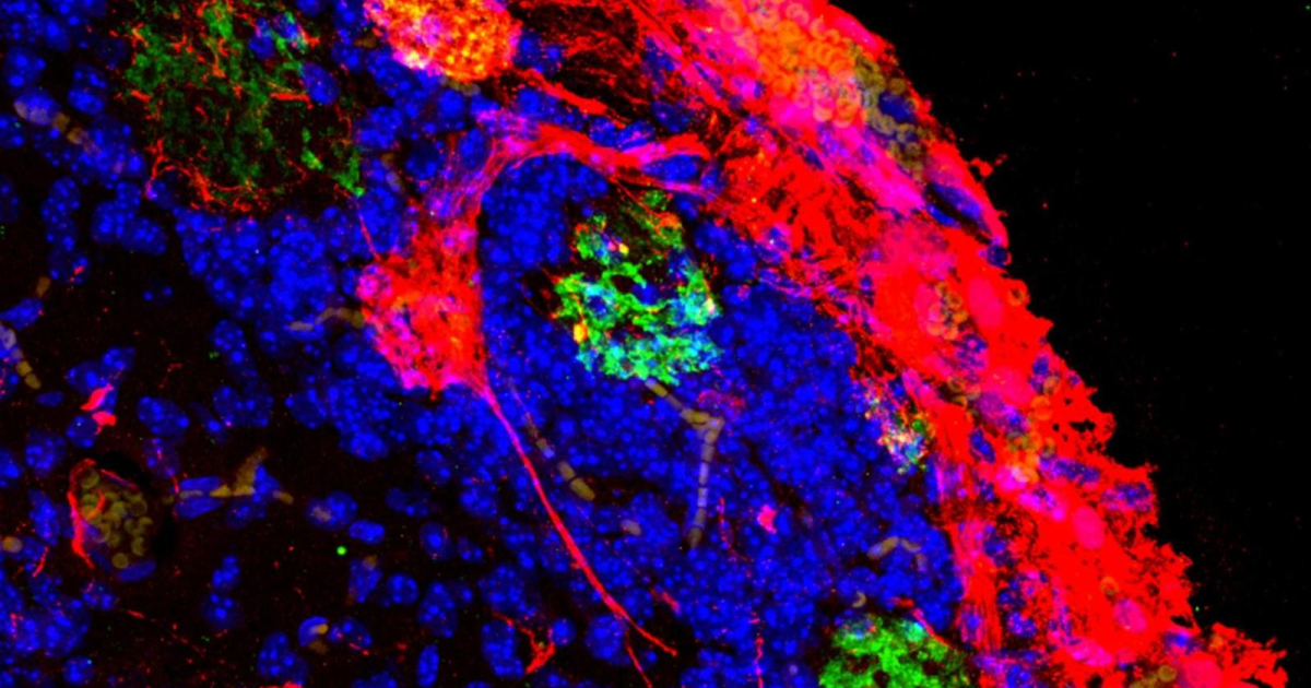 What hybrid mouse/rat brains are showing us about the mind