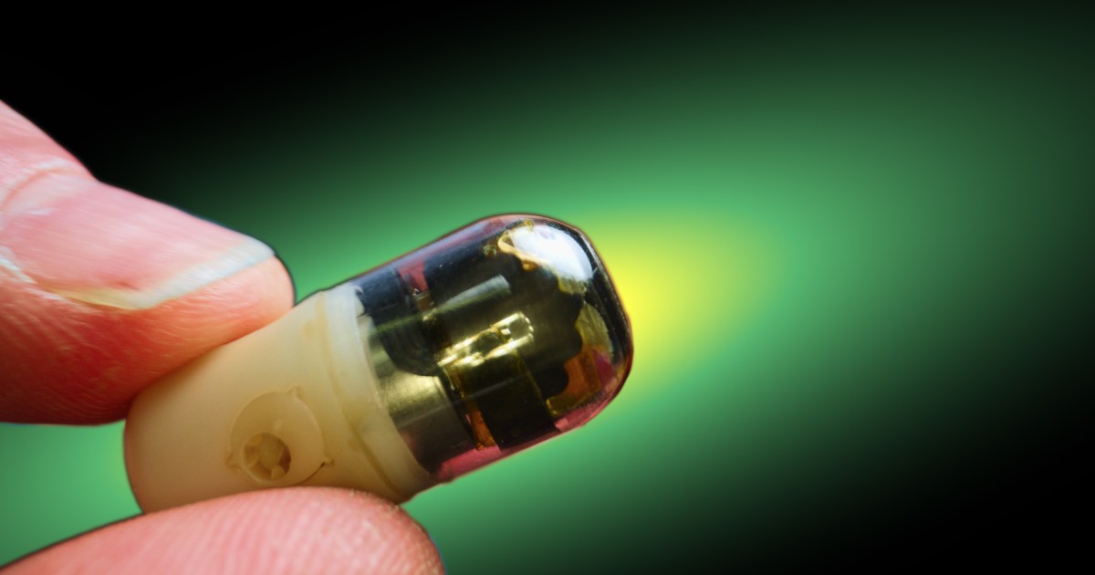 This tiny pill spies on your stomach